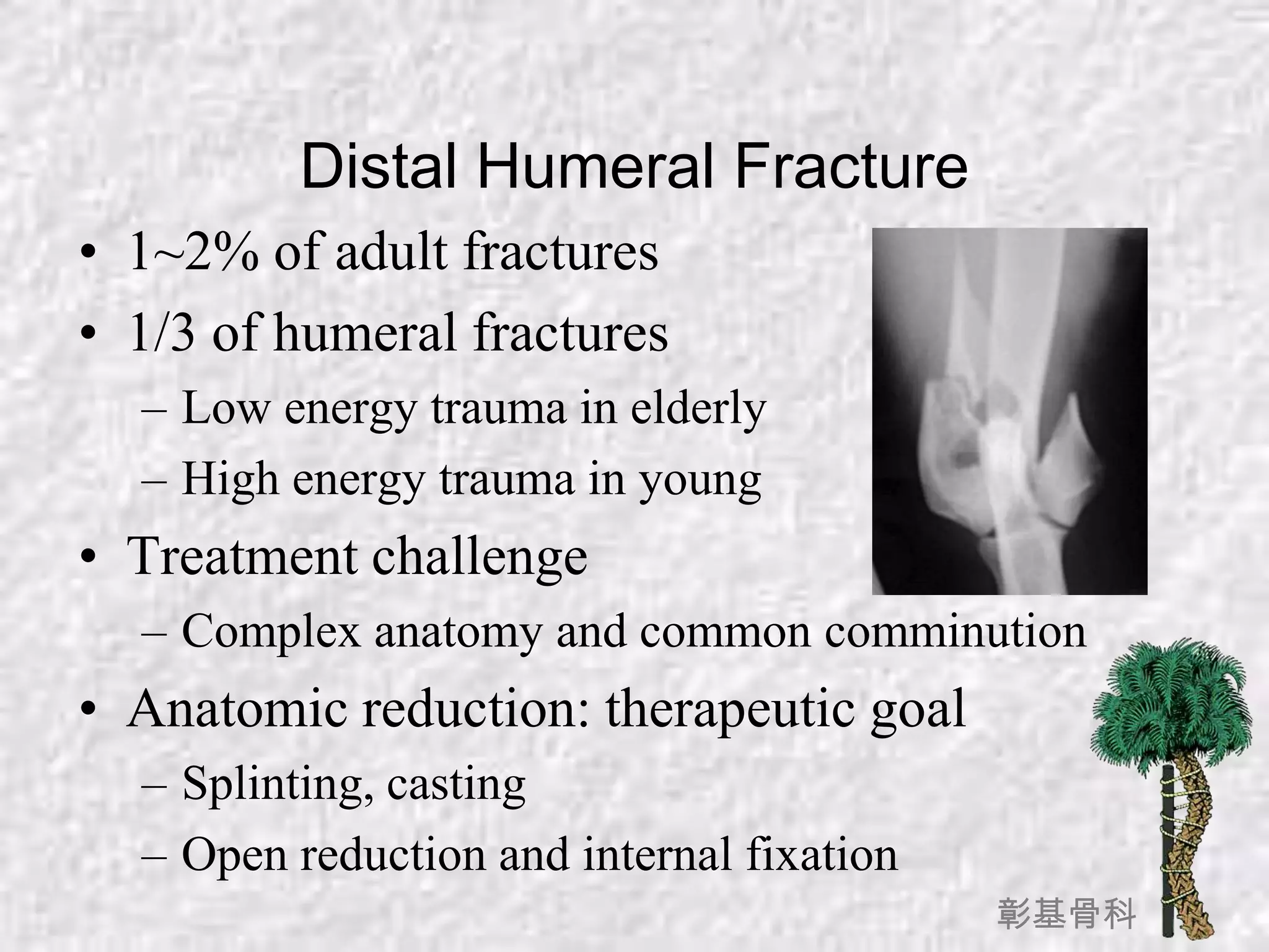 Total Elbow Arthroplasty As The Salvage procedure of Nonunion or ...