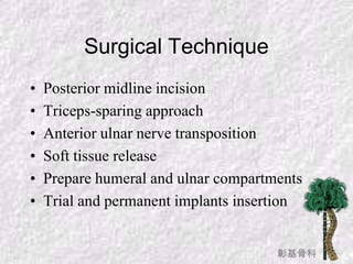 Total Elbow Arthroplasty As The Salvage procedure of Nonunion or ...