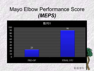 Total Elbow Arthroplasty As The Salvage procedure of Nonunion or ...