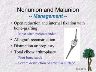 Total Elbow Arthroplasty As The Salvage procedure of Nonunion or ...