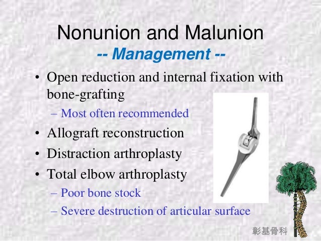 Total Elbow Arthroplasty As The Salvage procedure of Nonunion or Malu…
