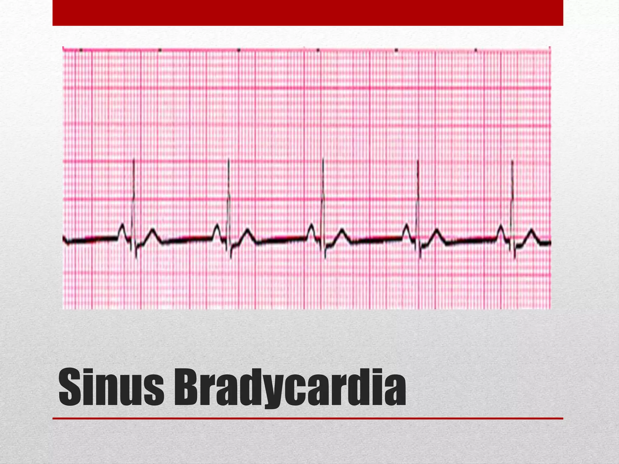 Brief info on 3 ER procedures | PPT