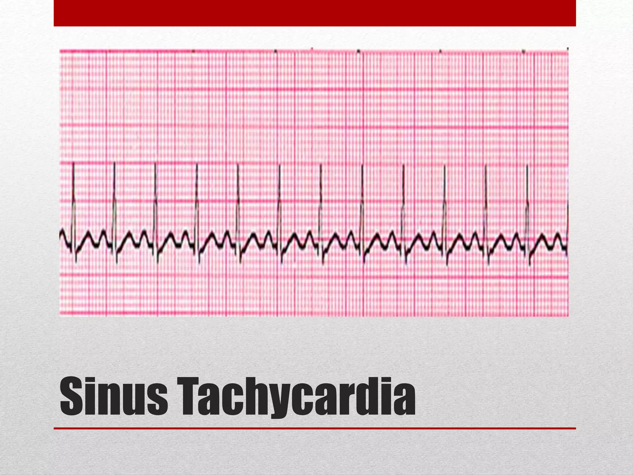 Brief info on 3 ER procedures | PPT