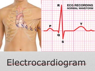 Brief info on 3 ER procedures | PPT