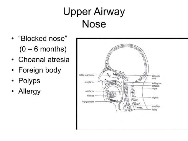 Upper airway-obstruction | PPT | Ear, Nose and Throat Conditions ...