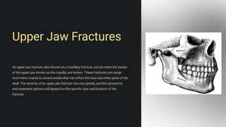 Upper-jaw-Fractures , mandible fracture . | PPT