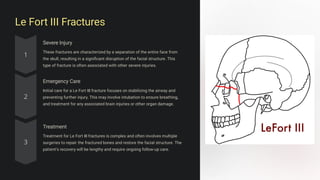 Upper-jaw-Fractures , mandible fracture . | PDF