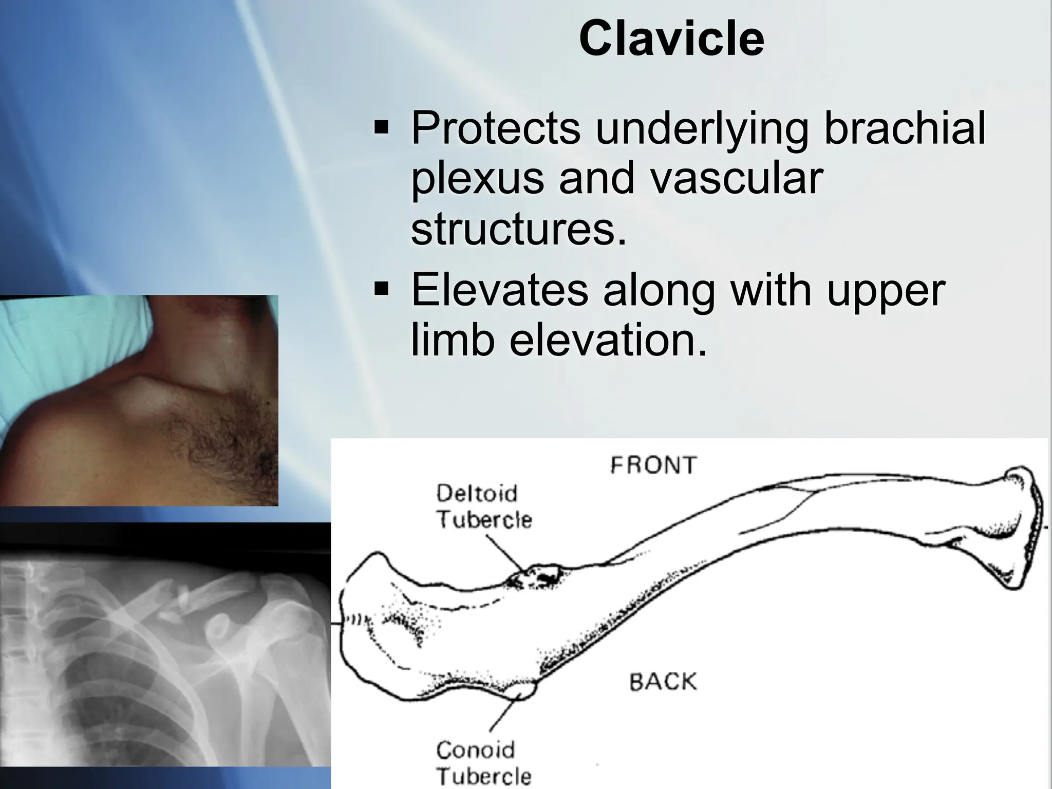 Upper-Limb-anatomyUpper limb anatomy part 2 for first and second year ...