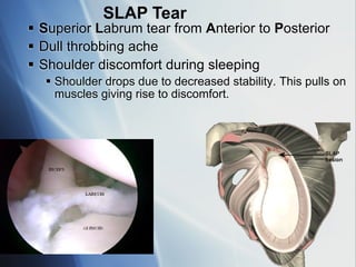 Upper-Limb-anatomyUpper limb anatomy part 2 for first and second year ...