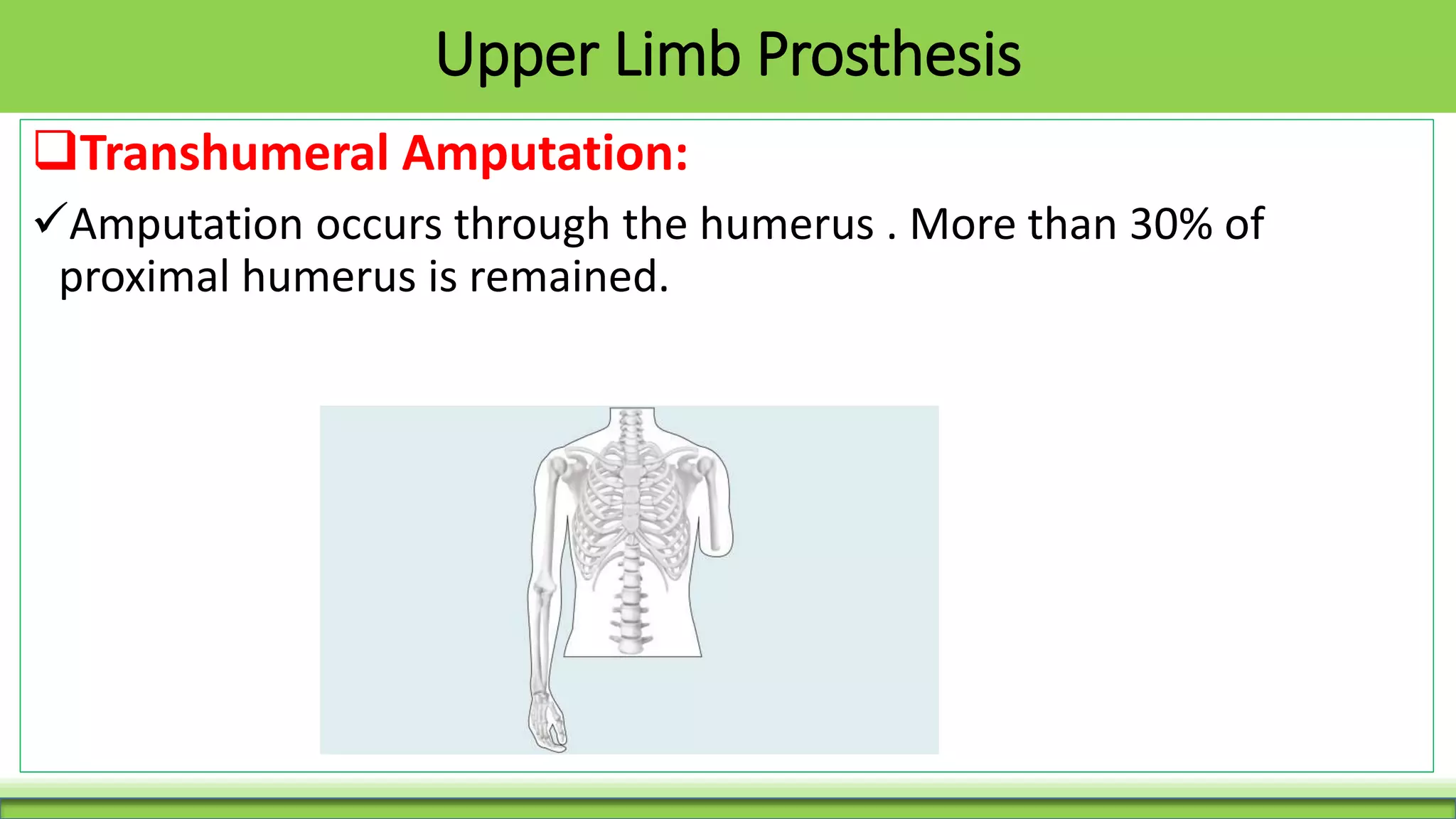 Upper limb-prosthesis-group1-presentation | PPTX