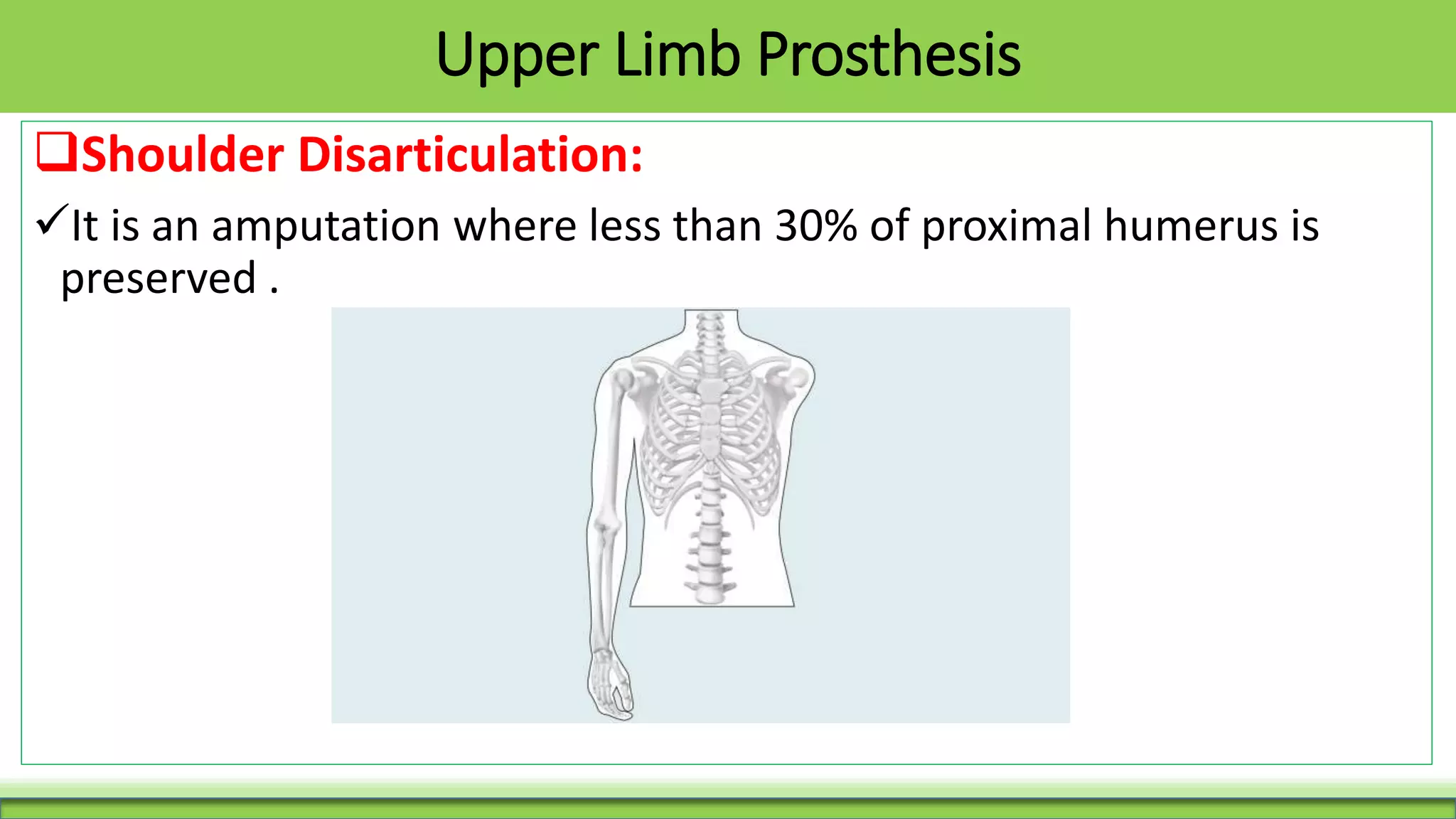 Upper limb-prosthesis-group1-presentation | PPTX