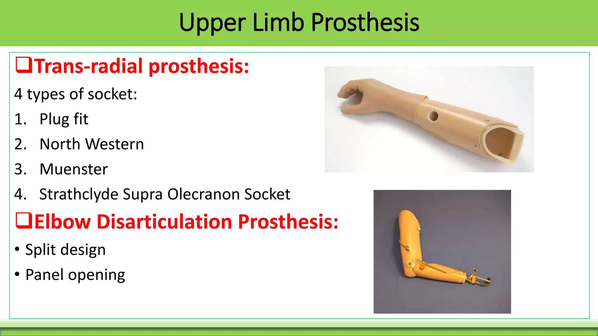Upper limb-prosthesis-group1-presentation | PPT