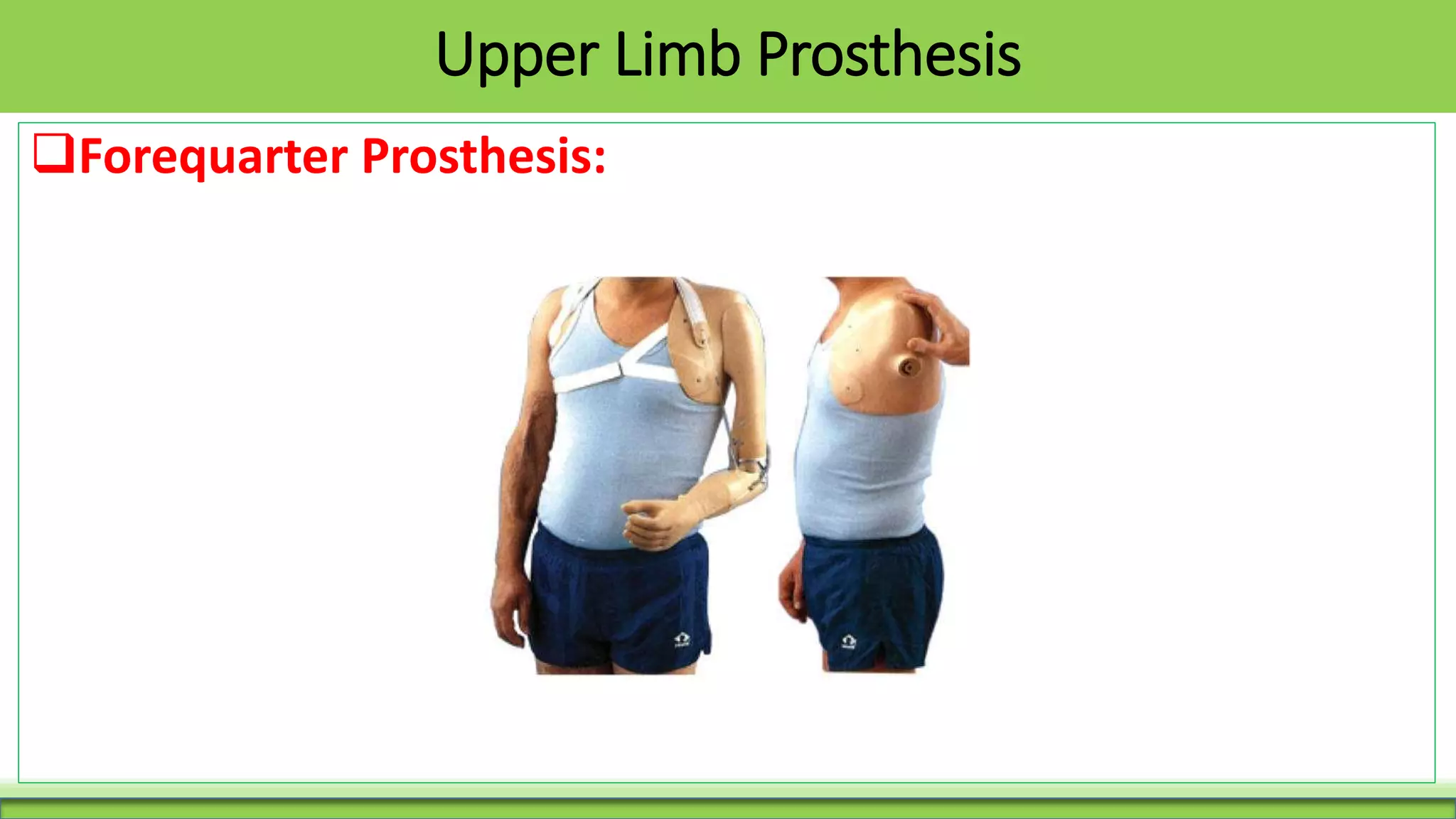 Upper limb-prosthesis-group1-presentation | PPTX