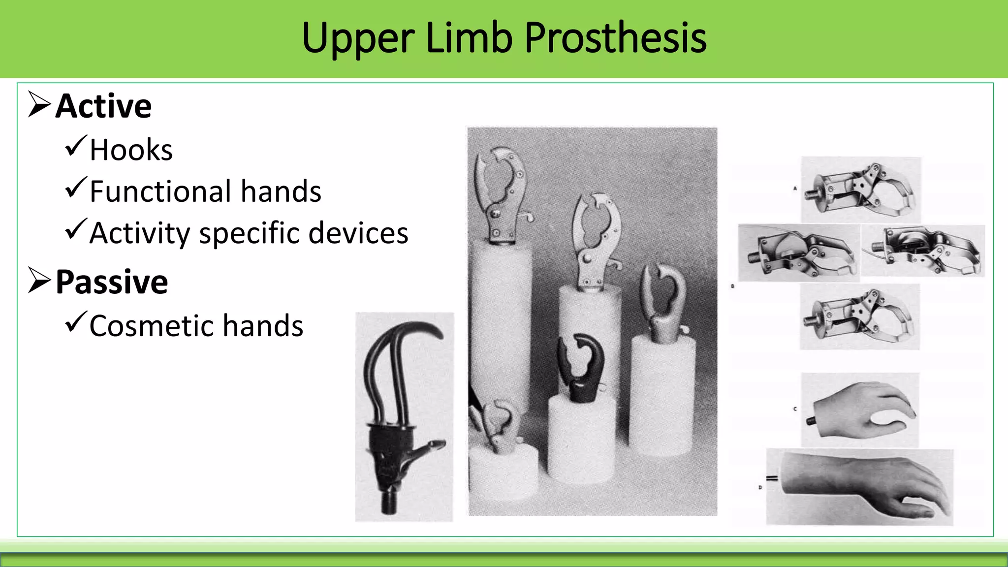 Upper limb-prosthesis-group1-presentation | PPTX