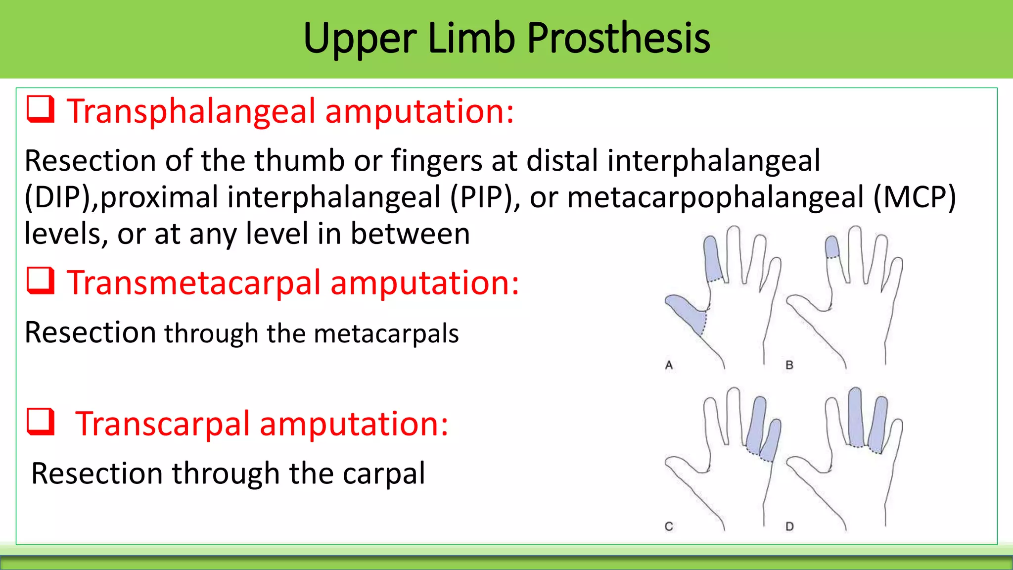 Upper limb-prosthesis-group1-presentation | PPTX