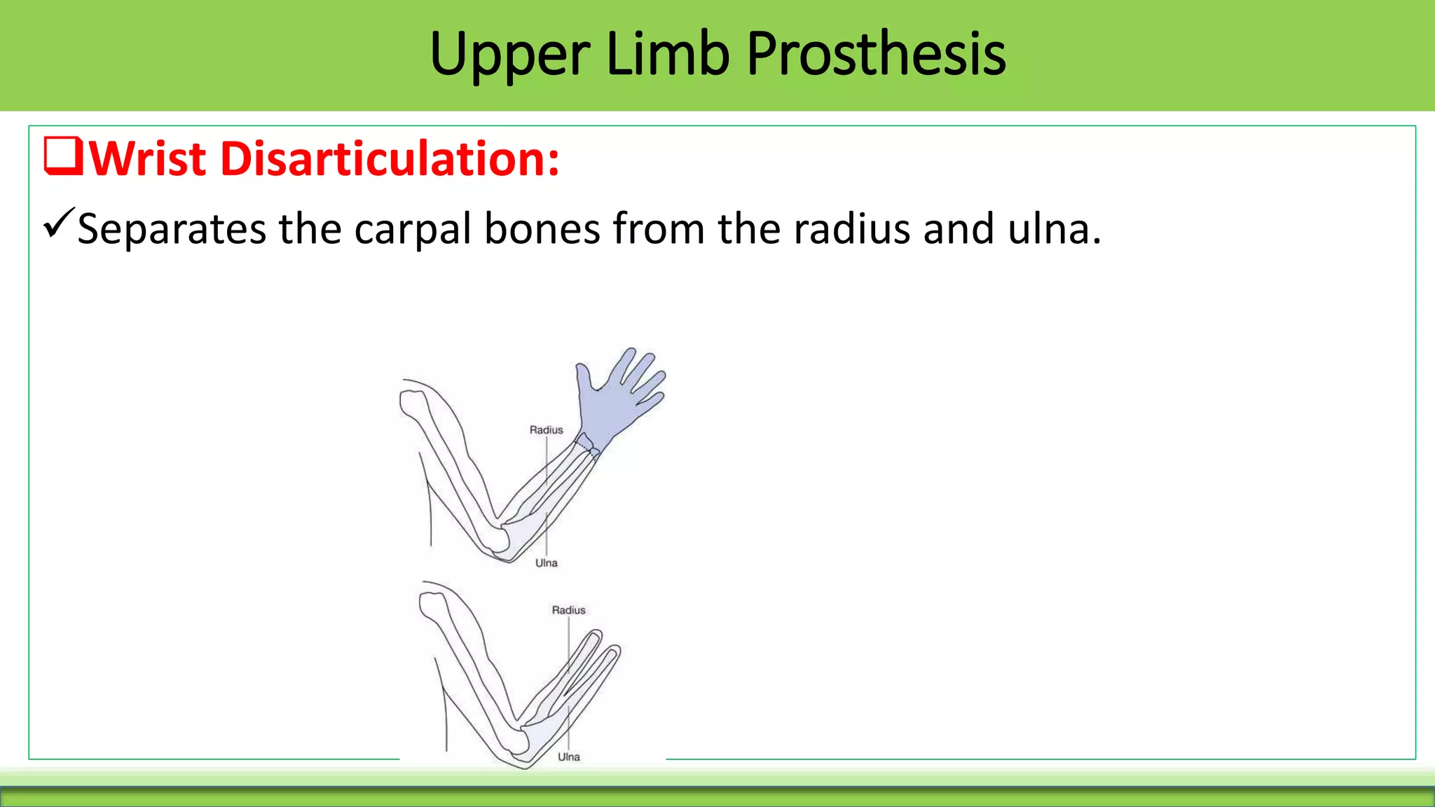 Upper limb-prosthesis-group1-presentation | PPTX