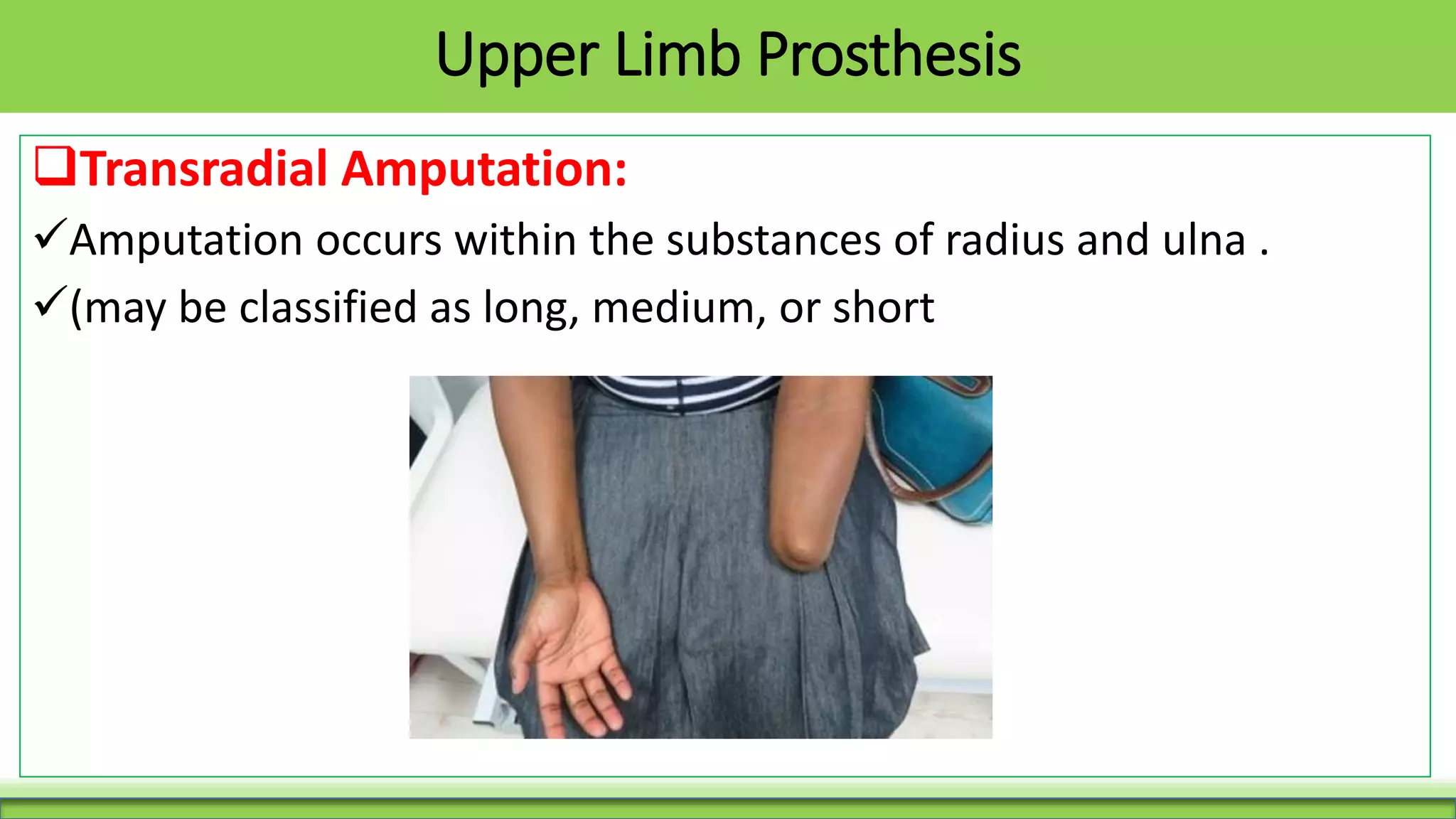 Upper limb-prosthesis-group1-presentation | PPTX