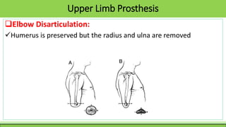 Upper limb-prosthesis-group1-presentation | PPTX