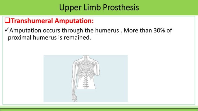 Upper limb-prosthesis-group1-presentation | PPTX
