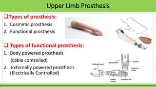 Upper limb-prosthesis-group1-presentation | PPTX