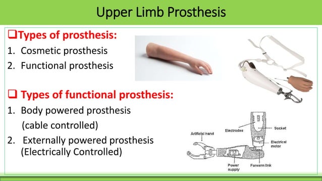 Upper limb-prosthesis-group1-presentation | PPTX
