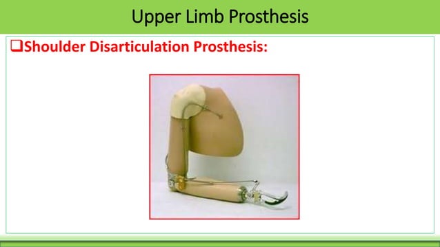 Upper limb-prosthesis-group1-presentation | PPTX