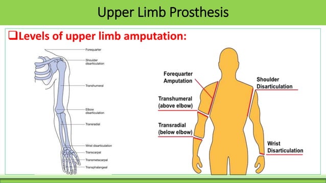 Upper limb-prosthesis-group1-presentation | PPTX