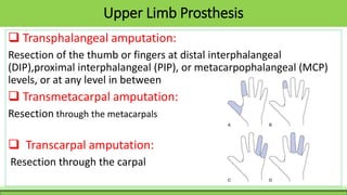 Upper limb-prosthesis-group1-presentation | PPTX