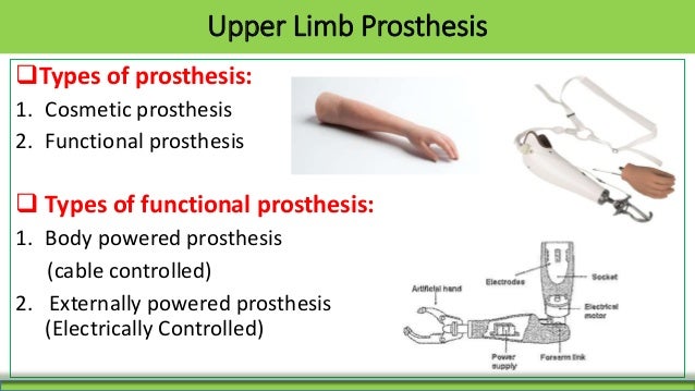 Upper limb-prosthesis-group1-presentation