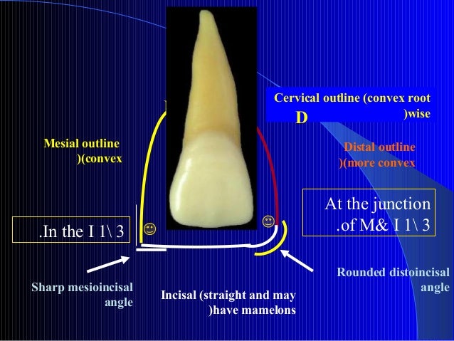 Upper Central Incisor