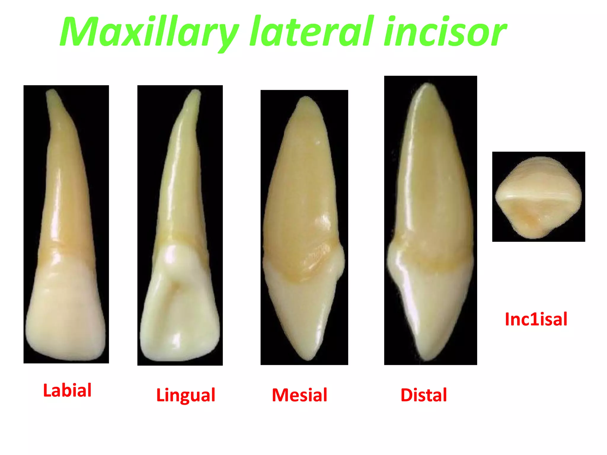 Upper Lateral Incisor | PDF