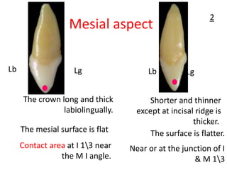 Upper Lateral Incisor | PDF
