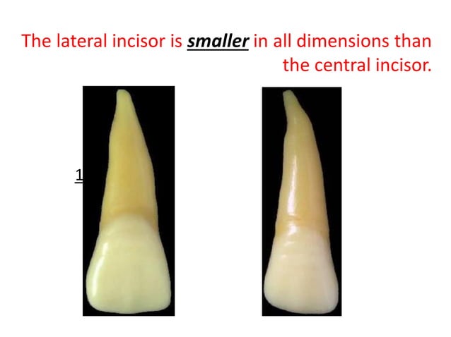 Upper Lateral Incisor | PPT
