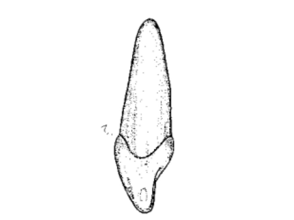 Upper Lateral Incisor