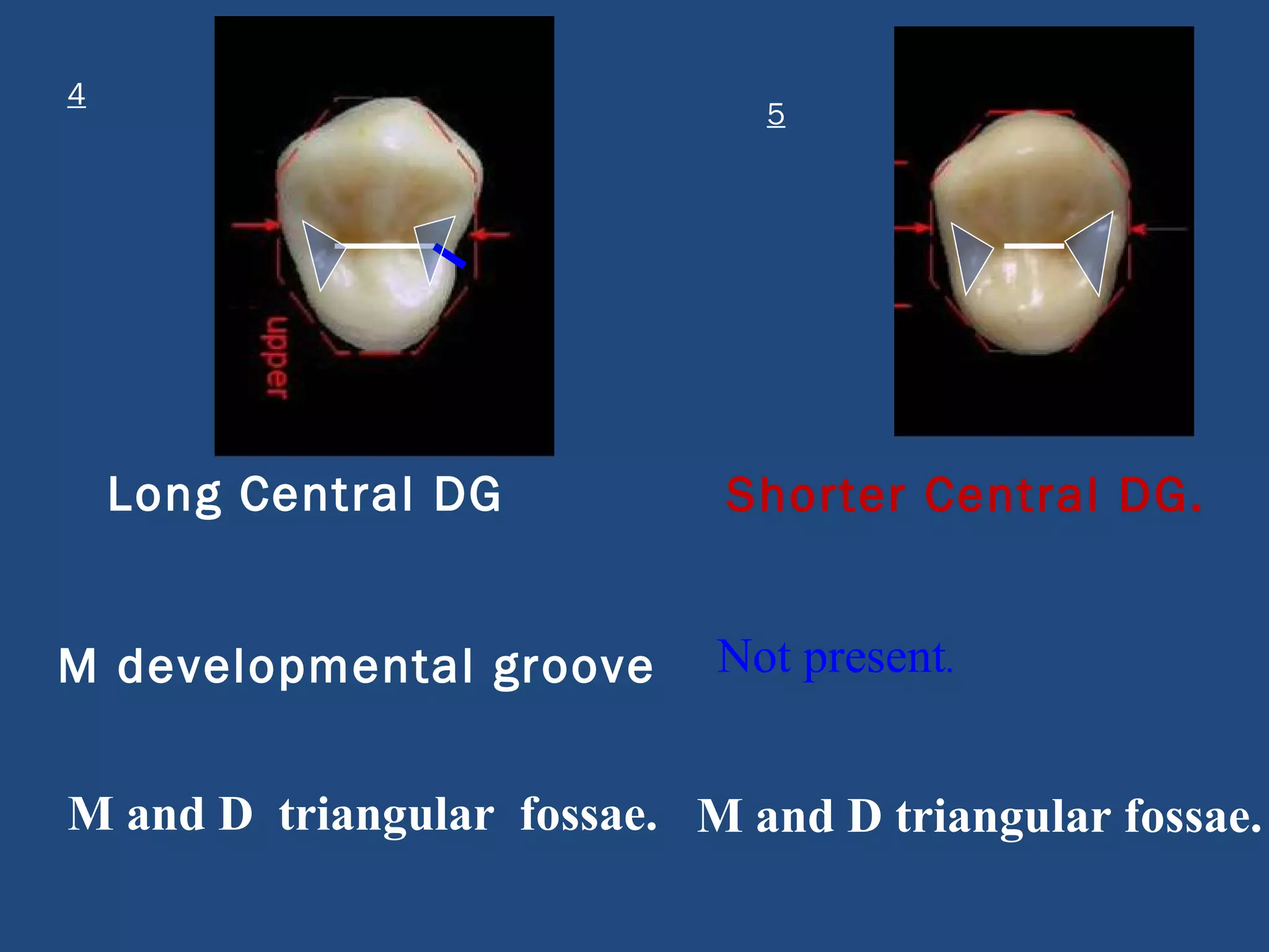 Upper Second Premolar Ppt 4753