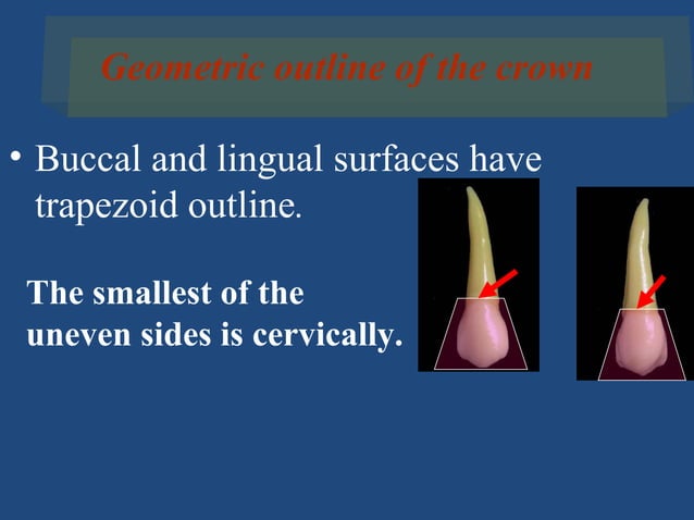 Upper Second Premolar | PPT | Dental Health | Diseases and Conditions