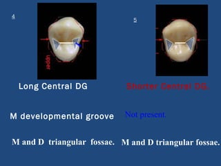 Upper Second Premolar | PPT