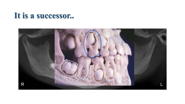 Maxillary second premolar | PPTX | Dental Health | Diseases and Conditions