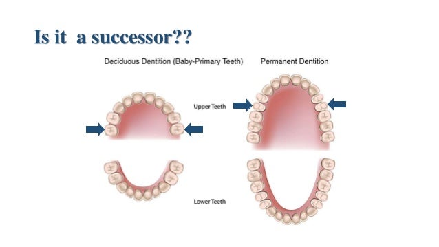 Maxillary second premolar