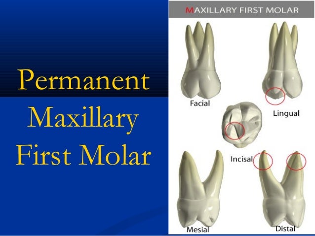 Upper First Molar