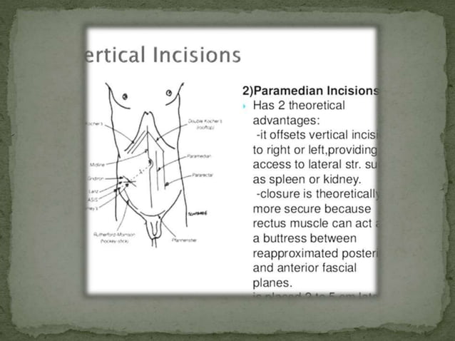 Upper abdominal surgery (hospital) pptx.pptx