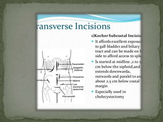 Upper abdominal surgery (hospital) pptx.pptx