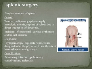 Upper abdominal surgery (hospital) pptx.pptx