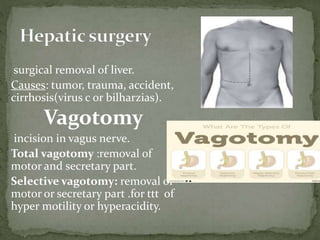 Upper abdominal surgery (hospital) pptx.pptx