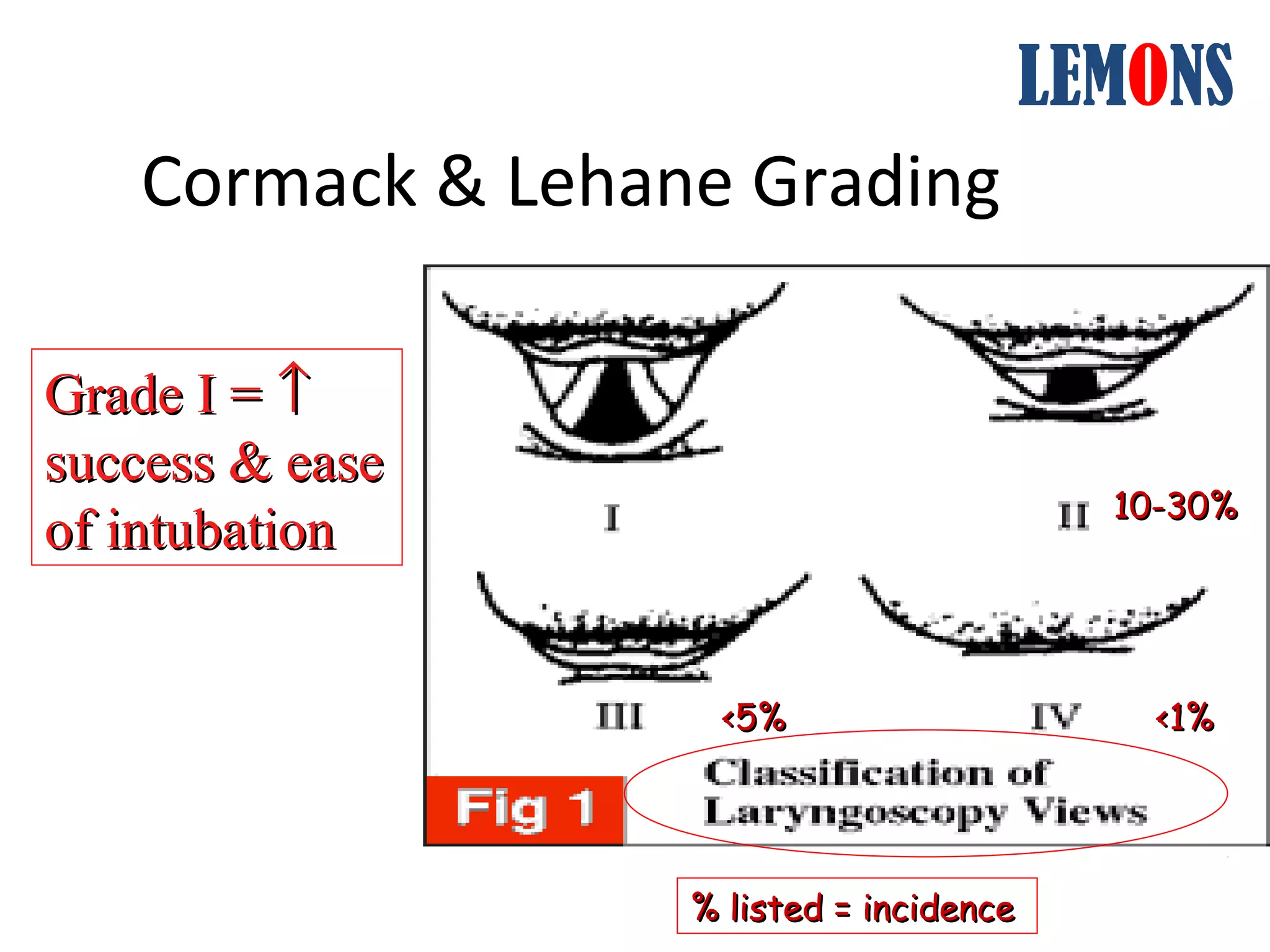 Upper airway assessment east iv | PPT