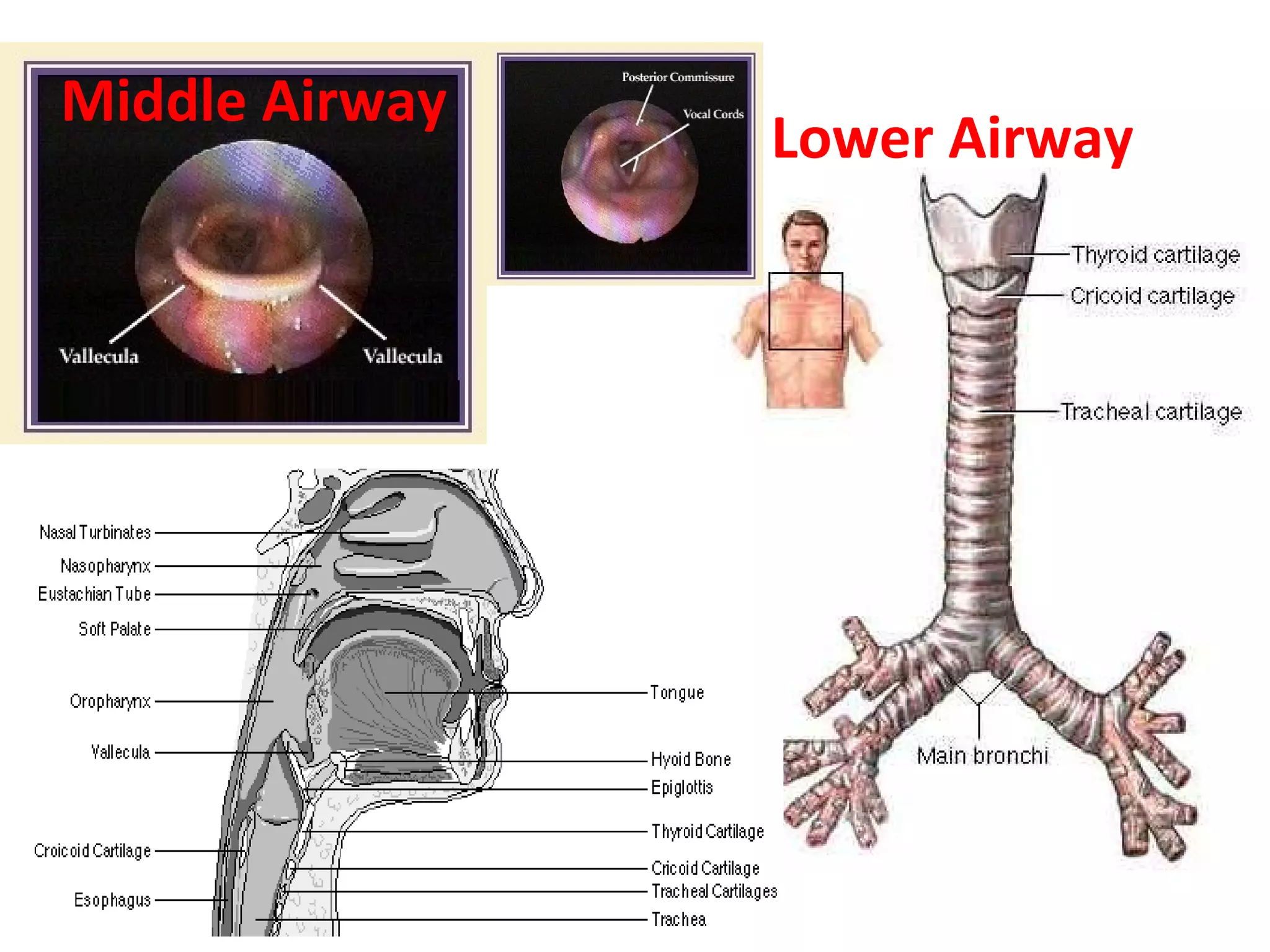 Upper airway assessment east iv | PPT