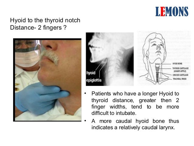 Upper airway assessment east iv