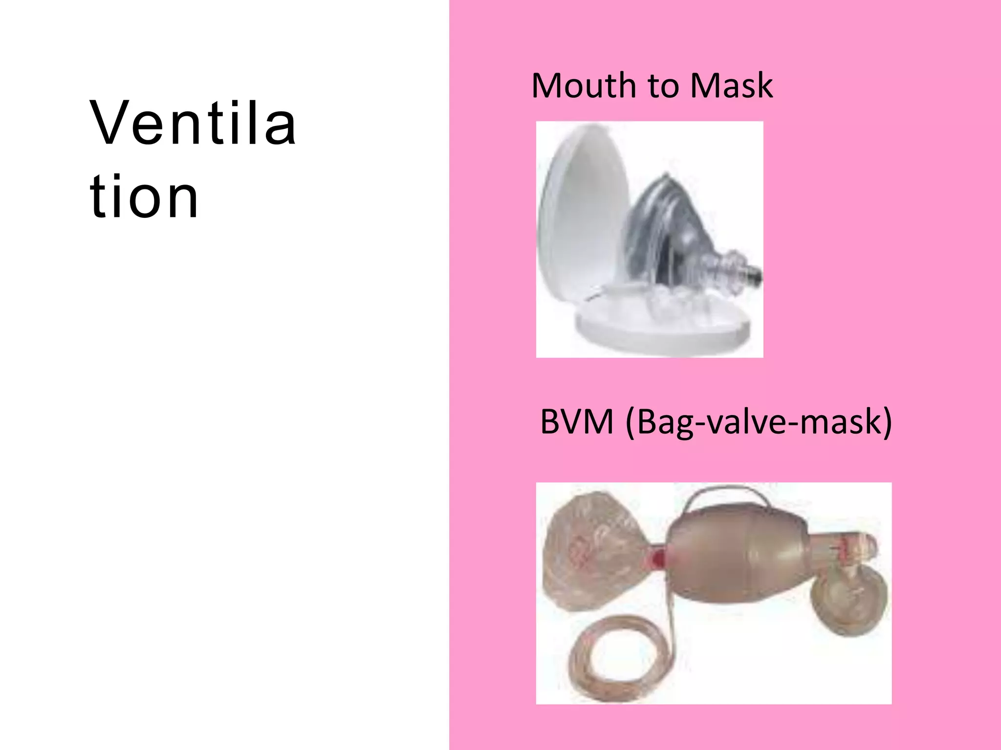 Upper airway management | PPTX