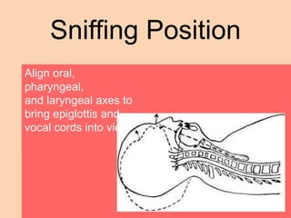 Upper airway management | PPT