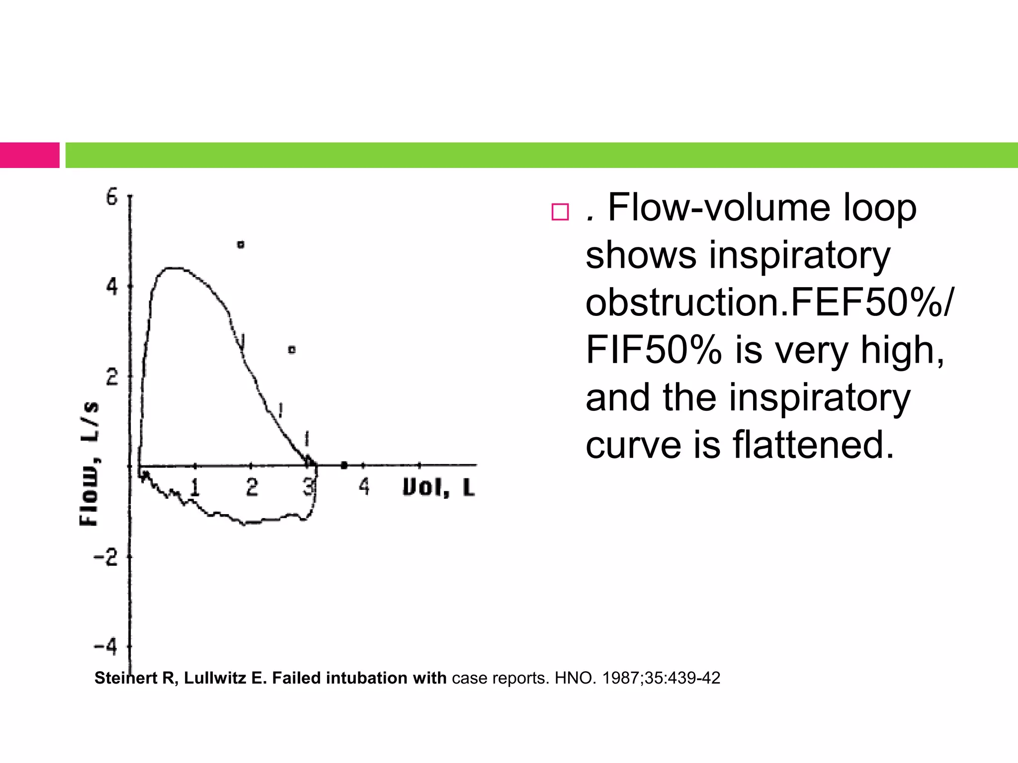 Upper airway obstruction | PPTX